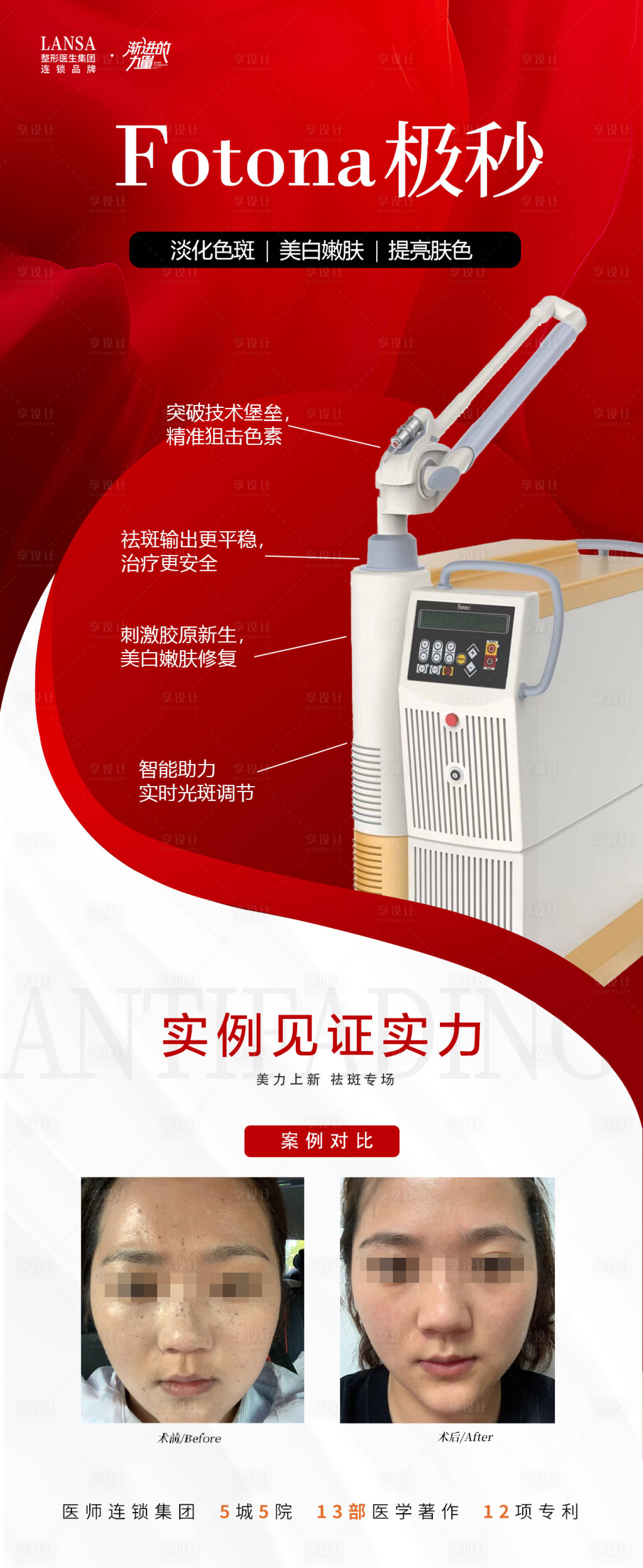 FOTONA极秒PSD广告设计素材海报模板免费下载-享设计