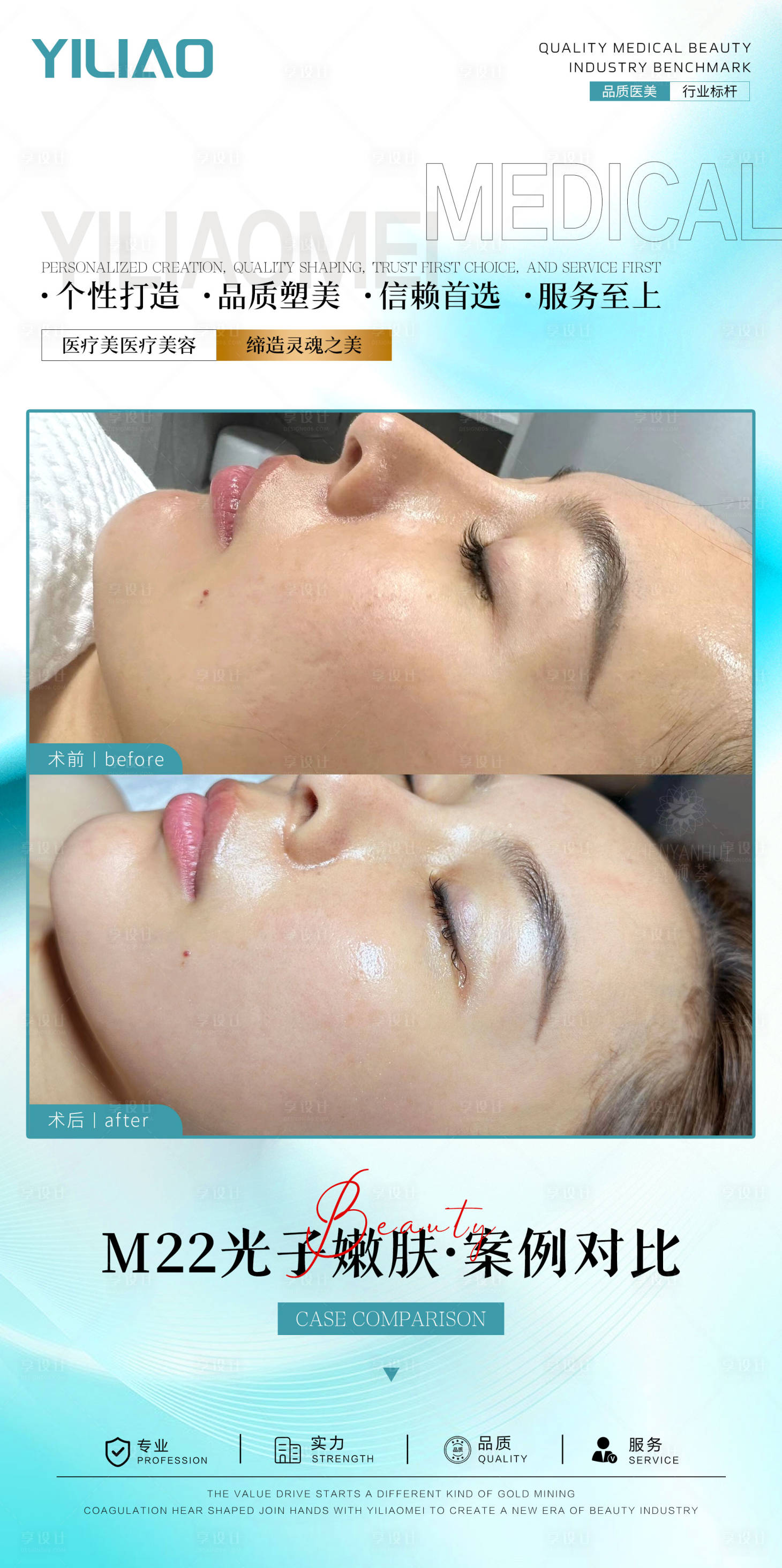 M22光子嫩肤案例对比海报PSD广告设计素材海报模板免费下载-享设计